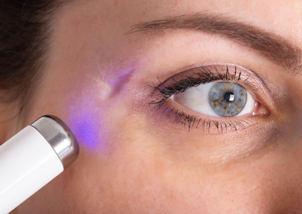 Litteken therapie: Wat is het en wat doet het?