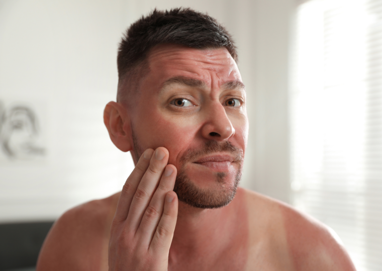 Edula® zalf | De beste zalf om littekens te voorkomen | Snelle levering