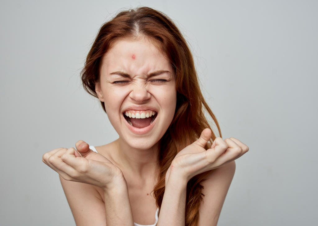 Pukkels op voorhoofd? Oorzaken en oplossingen + Edula® tip